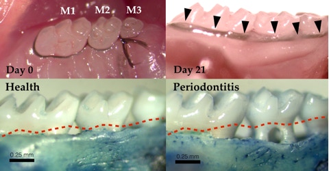 Periodontitis Modeling